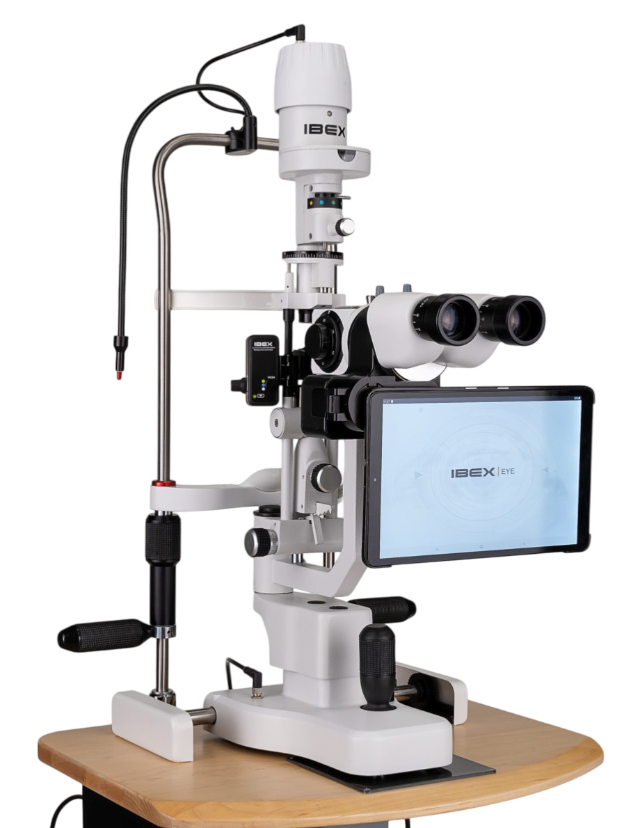 IMAGING SYSTEM - IBEXeye.com